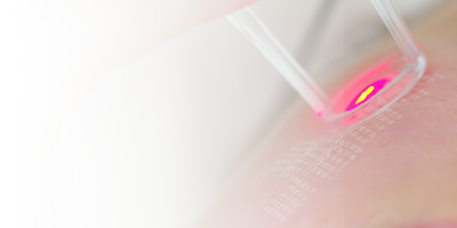 Non‑Ablative Fractional CO₂ Laser Resurfacing (Secret PRO) - Cosmetica ...