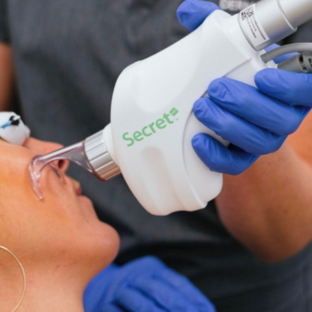 Non‑Ablative Fractional CO₂ Laser Resurfacing (Secret PRO) - Cosmetica ...